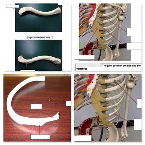 Ribs Anatomy Notes At Ebony Dunlop Blog