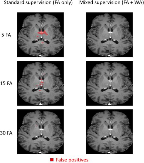 Comparison Of Our Approach With The Standard Supervised Learning For Download Scientific