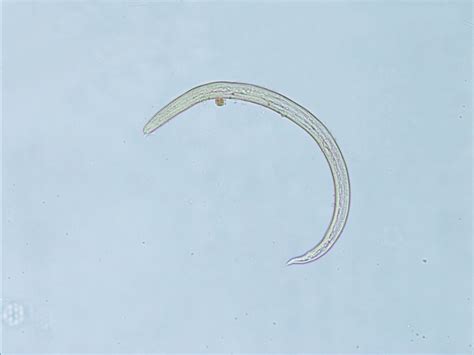 Can Mystery Snails Get Parasites Snailpedia