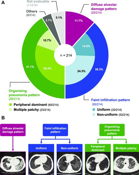 Ild Image Patterns N ¼ 214 A The Incidence Of Each Ild Image Download Scientific Diagram