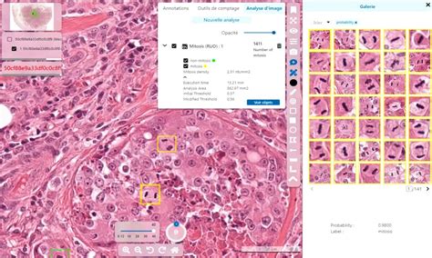 Ai Algorithm Mitosis By Tribun Health