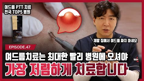 여드름의 기본 원리 및 치료방법 그리고 여드름이 났을때 절대 하면 안되는 행동 Youtube