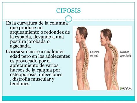 Lesiones Columna Vertebral