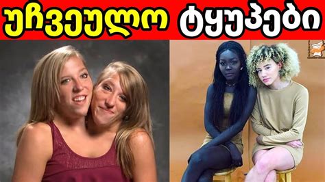ტყუპები რომელთა არსებობაც რთული დასაჯერებელია Youtube