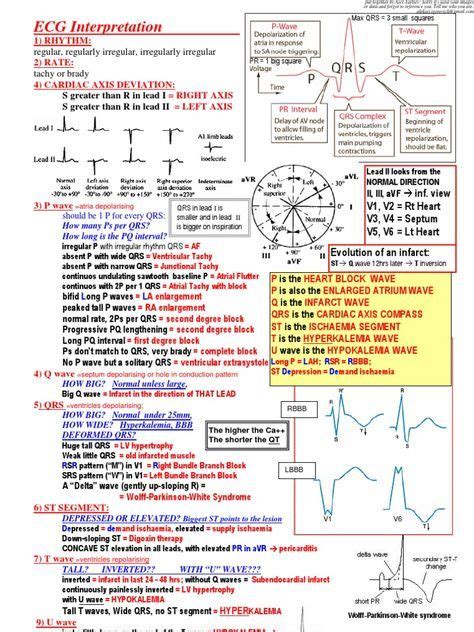 Ecg Notes Artofit