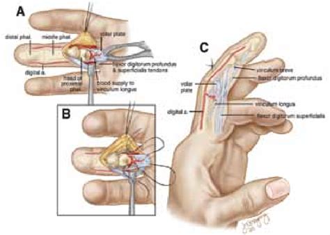 Volar Vs Dorsal Surface