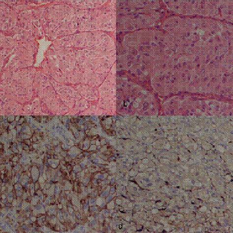 A A Low Power View Of The Mass Showing Nested Architecture And