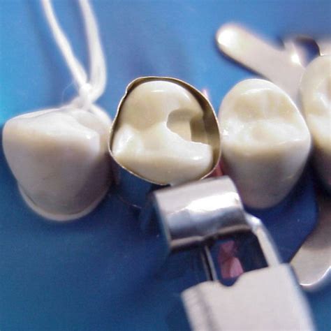 Tdv Tofflemire Matrix Sunny Dental Medical Supply