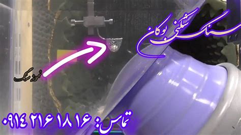 چگونگی شکستن سنگ کلیه با لیزر