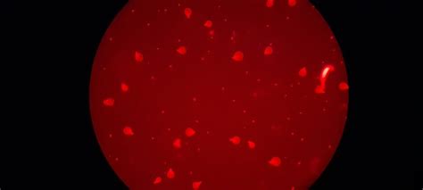 This Is Regarding Comet Assay What Is The Cause For Uneven Migration Directional Of Dna