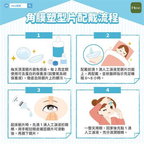 角膜塑型片矯正近視效果好醫師解答關於角膜塑型常見 5 個疑問 Heho健康
