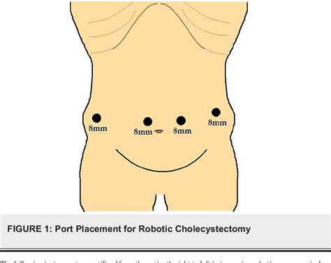 Figure 1 From Robotic Cholecystectomy Remains Safe And Effective After Regular Staffing Hours