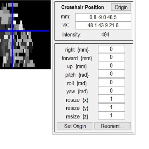 Statistical Parametrical Mapping Toolbox The Image Represents A Slice Download Scientific