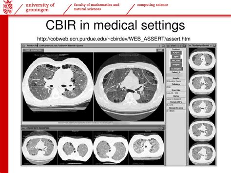 Ppt Content Based Image Retrieval Cbir Of Dermatological Images Powerpoint Presentation Id