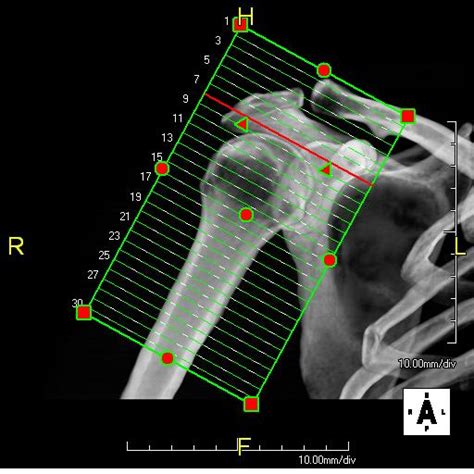 Msk Ct Protocols