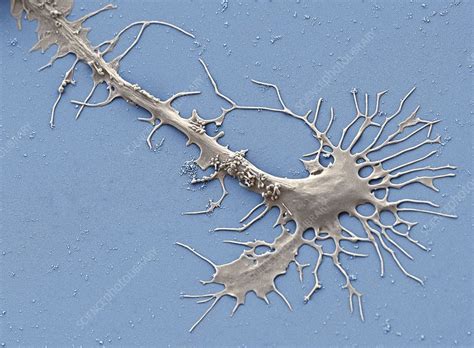 Stem Cell Derived Neuron Growth Cone Sem Stock Image C029 8217 Science Photo Library