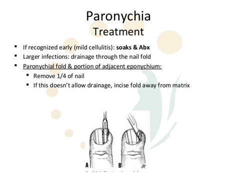 Hand Infections