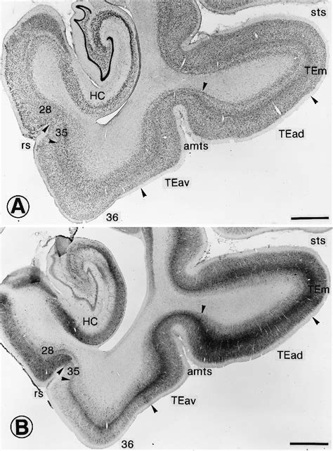 Pdf Divergent Projections From The Anterior Inferotemporal Area Te To Pdf Divergent Projections From The Anterior Inferotemporal Area Te To