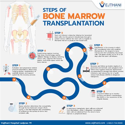 Steps Of Bone Marrow Transplantation Vejthani International Hospital
