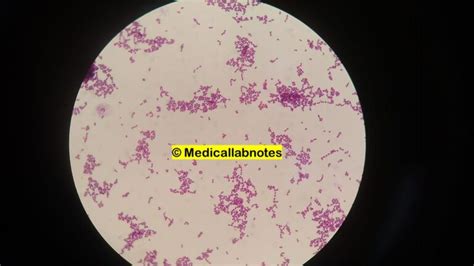 Streptococcus Oralis Introduction Morphology Pathogenicity