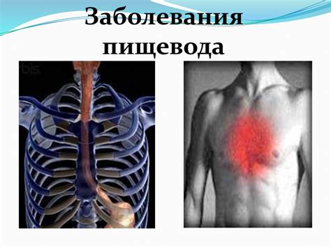 Патология желудочно кишечного тракта презентация онлайн