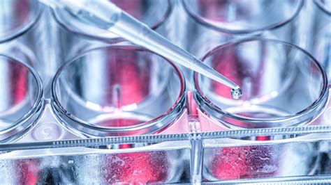 Five Intelligent Ways To Accelerate Cell Line Development Technology