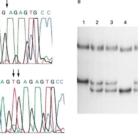Characterization Of The Mutation In The Gene For The B Subunit Of Download Scientific Diagram