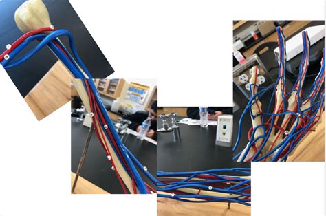 Arm V And A Diagram Quizlet