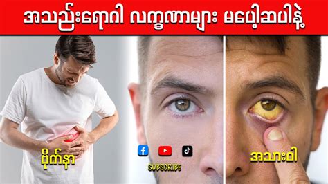 အသည်းရောဂါ လက္ခဏာများ အသည်းရောင်ရင် လုံးဝမပေါ့ပါနဲ့ Youtube