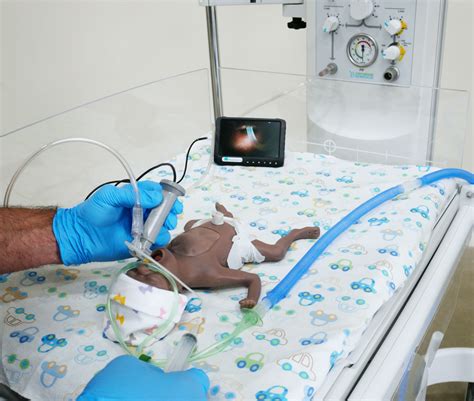 Neoview Video Laryngoscope Int Bio