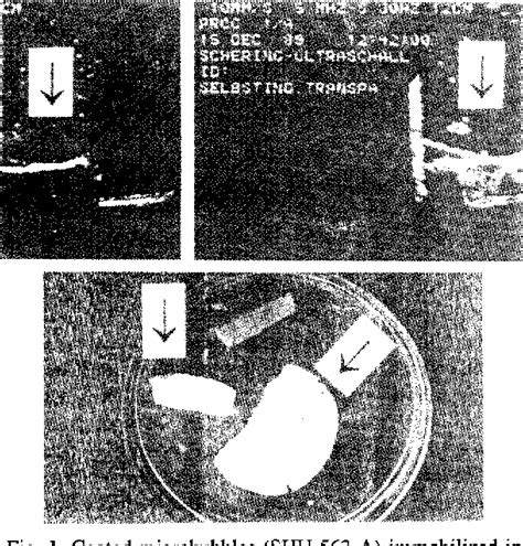 Figure 1 From Nonlinear Acoustical Response Of Coated Microbubbles In