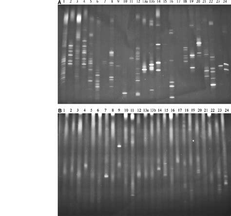 TCR Clonotype Mapping Of The T Cells Infiltrate In A Primary Melanoma Download Scientific