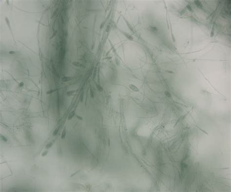 Microsporum Nanum The Macroconidia Enlarged Terminal Stru… Flickr