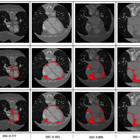 Some Examples Of The Predictions Of The Segmentation Model The
