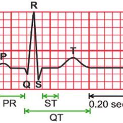 Typical ECG Signal 8 Download Scientific Diagram
