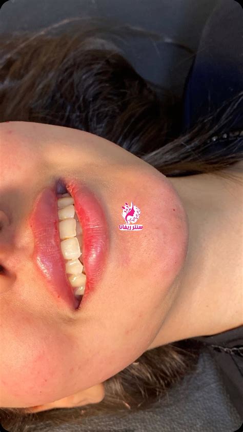 ‎سنتر ريفانا‎ ‎جلشفرنشاكريليكأظافر منيكيربديكير اكرلك‎ Instagram