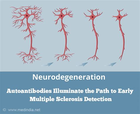 Autoantibodies Enable Early Detection Of Multiple Sclerosis