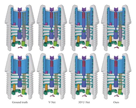 Segmentation Results Of The Different Algorithms Download Scientific