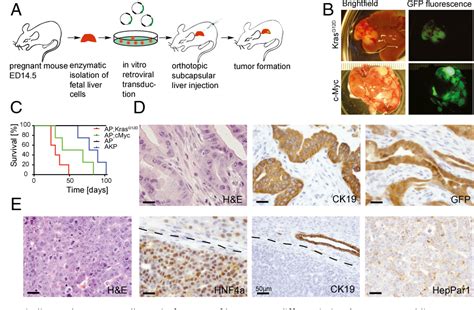 Figure 3 From Mouse Model Of Intrahepatic Cholangiocarcinoma Validates