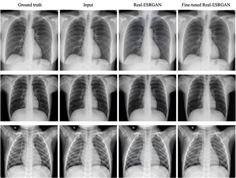 Github Alireza Aghelanmedical Image Super Resolution Fine Tuned Real Esrgan Model For