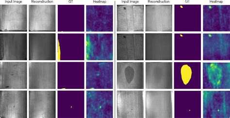 Figure 10 From Anomaly Detection With Conditioned Denoising Diffusion Models Semantic Scholar