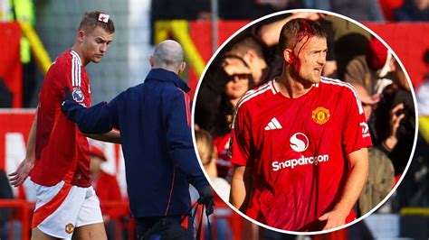 Fotos La Sangrienta Herida De Matthijs De Ligt Bein Sports