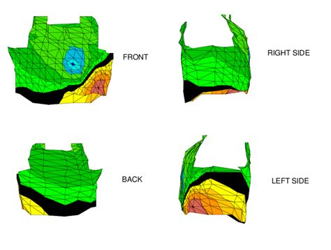 Sample Of Body Surface With Potentials Overlaid Analogous To Display