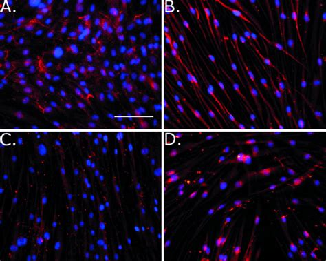 Microscopic Assays Of Collagen Fibrils Deposited In Fibroblast Cultures