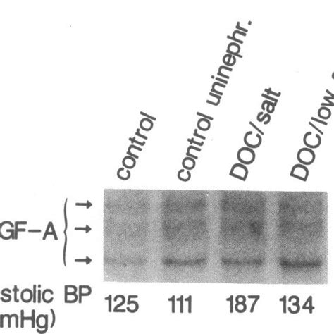Pdgf Gene Expression In Aortic Tissue Northern Blot Hybridization