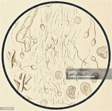 Sperm Microscope Photos And Premium High Res Pictures Getty Images