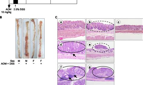 Figure From The Effect Of Sex On The Azoxymethane Dextran Sulfate Sodium Treated Mice Model Of