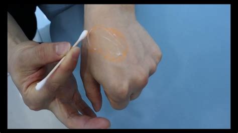 피부과전문의가 직접 알려주는 미백연고 바르는법 Youtube