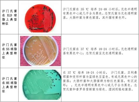 干货 微生物菌落特征形态总结大全 知识概念 实验与分析