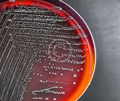 Genetic Testing Medphar Life Sciences
